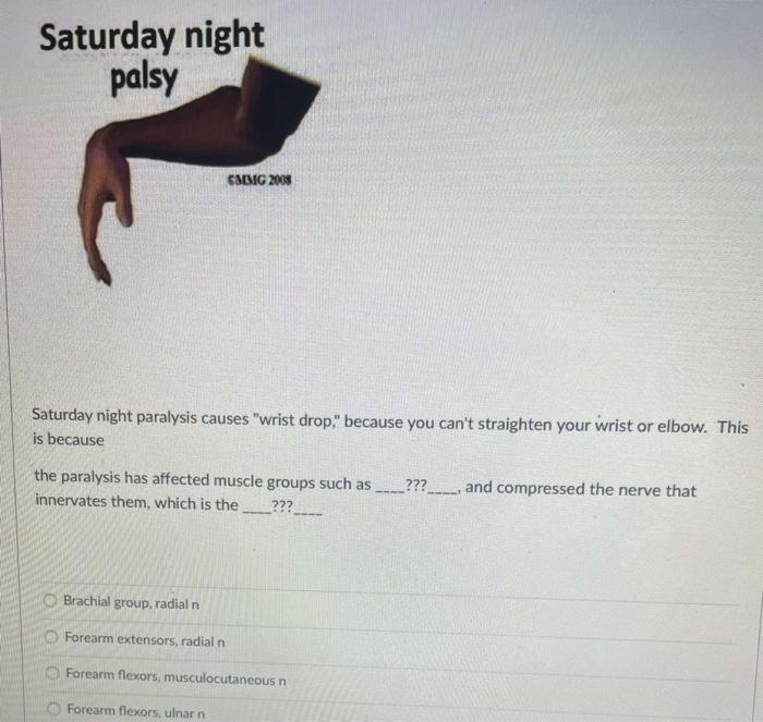 Solved Saturday night palsy CMMG 2008 Saturday night | Chegg.com