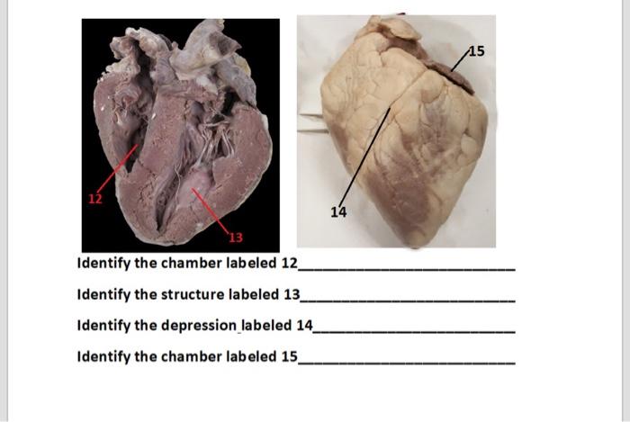 Solved 15 12 14 13 Identify the chamber labeled 12_ Identify | Chegg.com