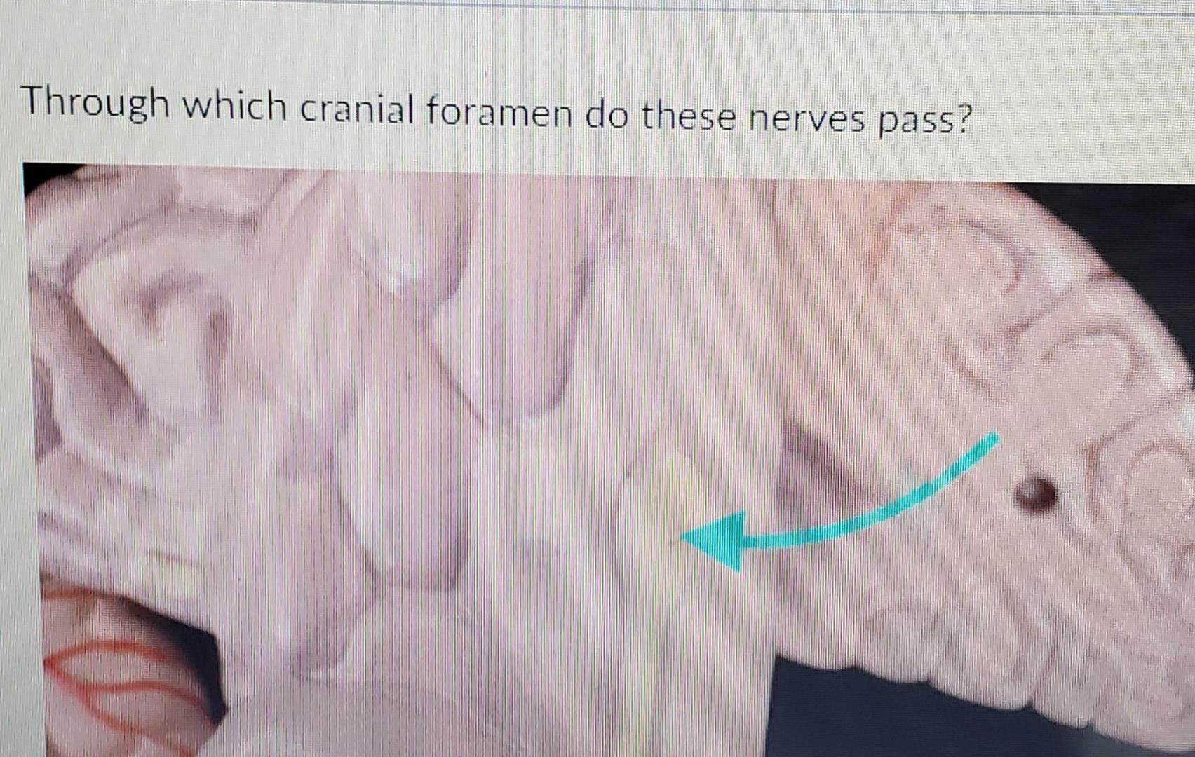 Solved Olfactory foramina Jugular foramen Superior orbital | Chegg.com