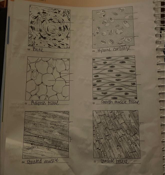 Solved (1) (9) Bone ADA 6 K Adipose tissue (*)_strated | Chegg.com