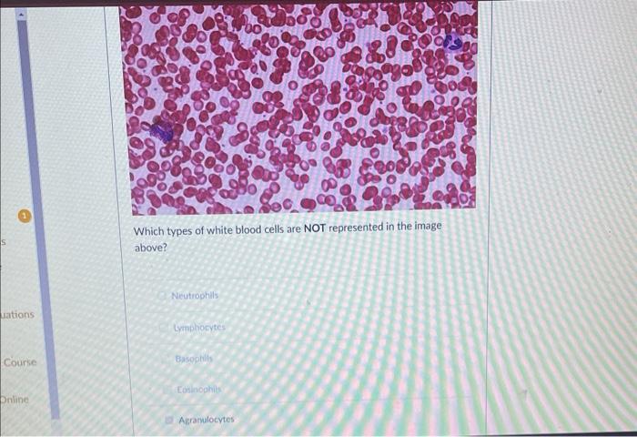 Solved Which of the following stains is commonly used to | Chegg.com