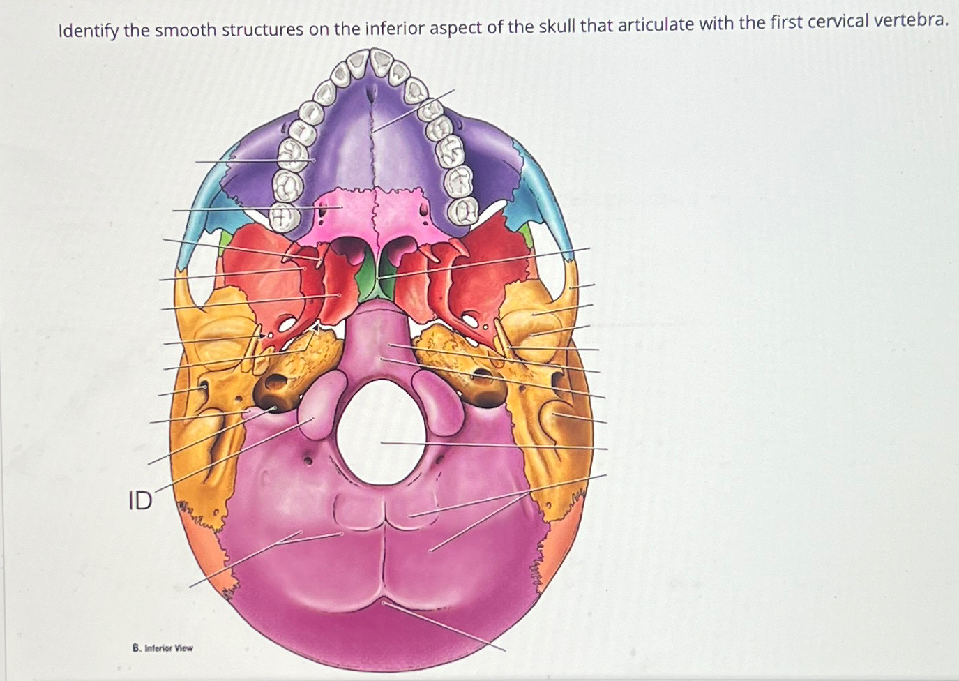 Solved Identify the smooth structures on the inferior aspect | Chegg.com