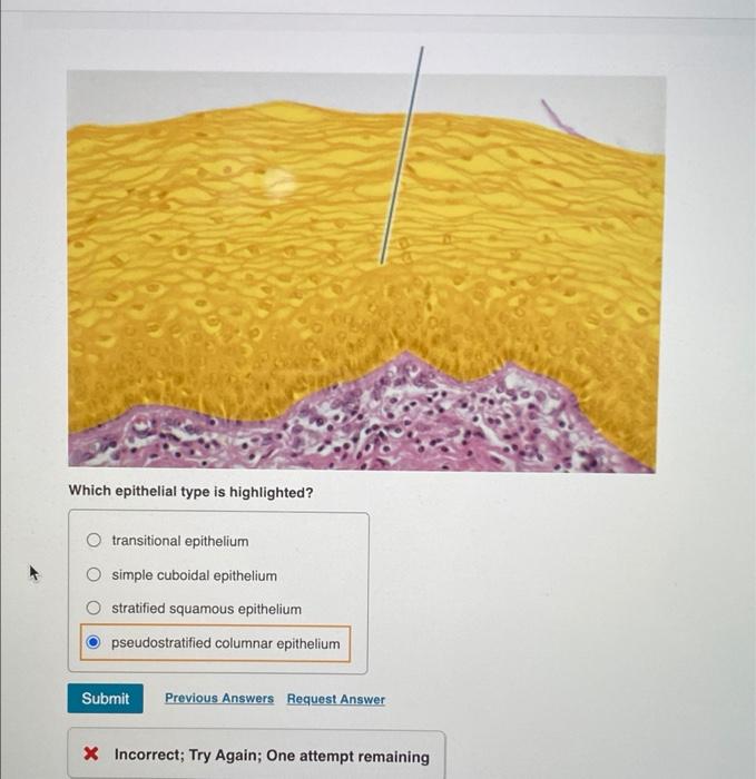Solved Which epithelial type is highlighted? transitional | Chegg.com