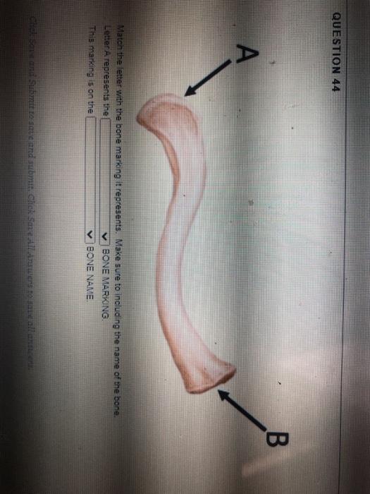 Solved QUESTION 44 B A Match the letter with the bone | Chegg.com