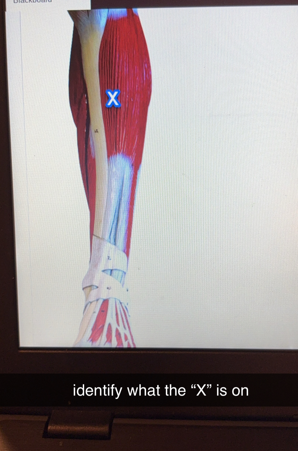 Solved identify what the " x " ﻿is on | Chegg.com