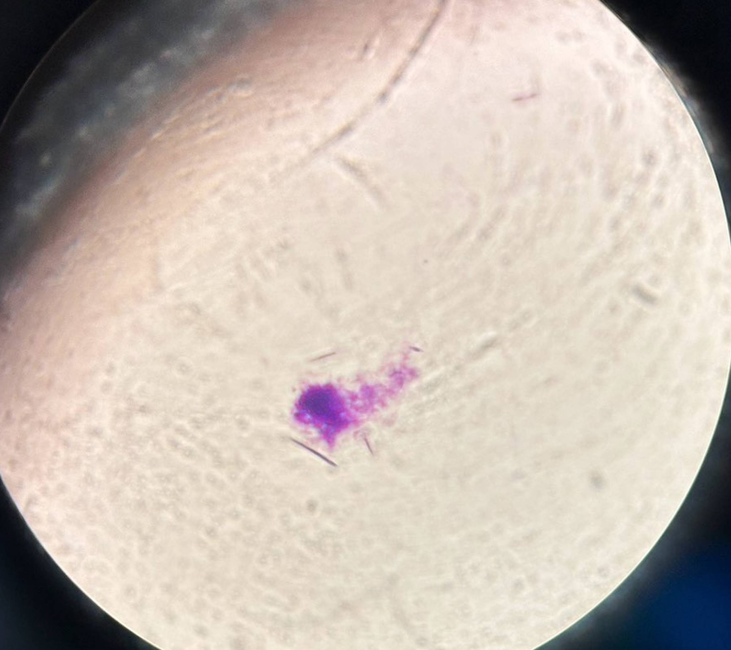 Solved What is the gram reaction and cell shape and | Chegg.com
