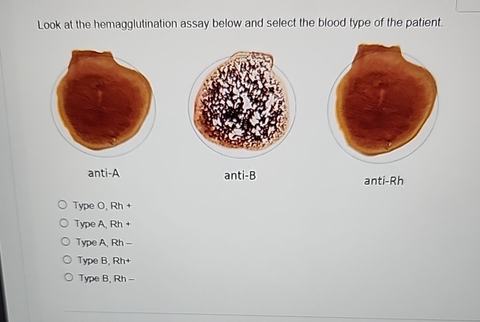 Solved Look at the hemagglutination assay below and select | Chegg.com