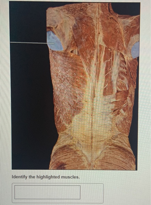 Solved Identify the highlighted muscles. | Chegg.com