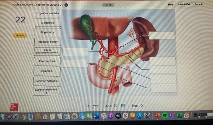 Solved Correctly label the following arteries of the abdomen | Chegg.com