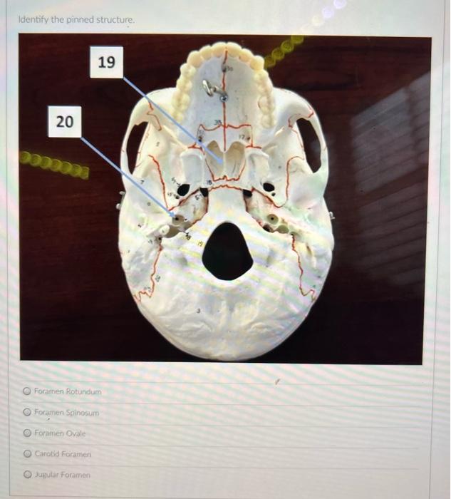 Solved Identify the pinned structure. Perpendicular. Plate | Chegg.com