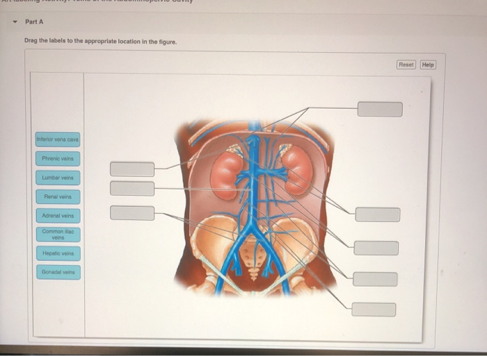 Solved Art-labeling Activity: Arteries of the Abdominopelvic | Chegg.com