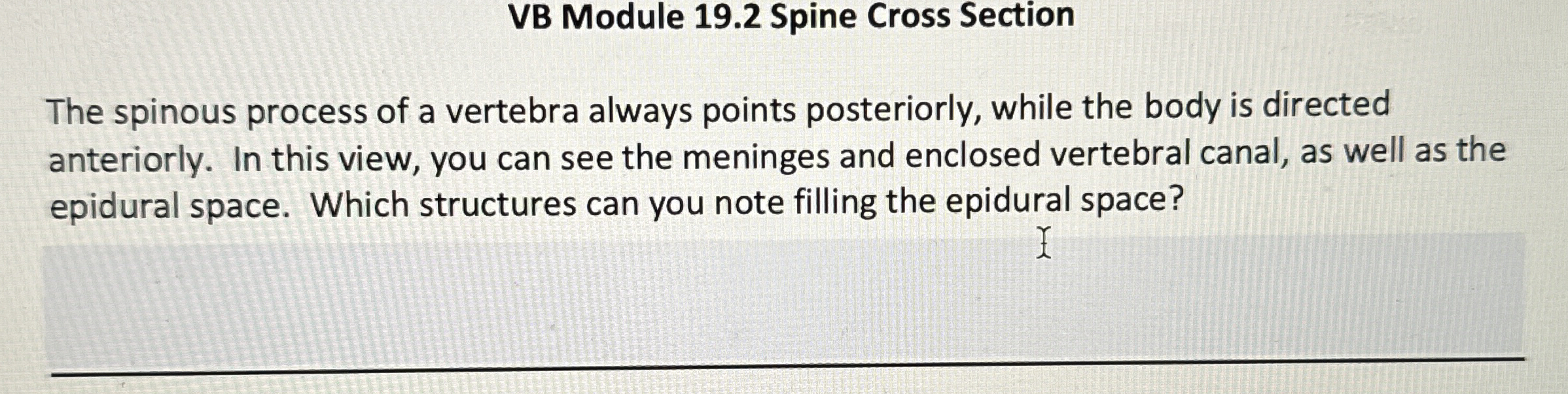Solved VB Module 19.2 ﻿Spine Cross SectionThe spinous | Chegg.com