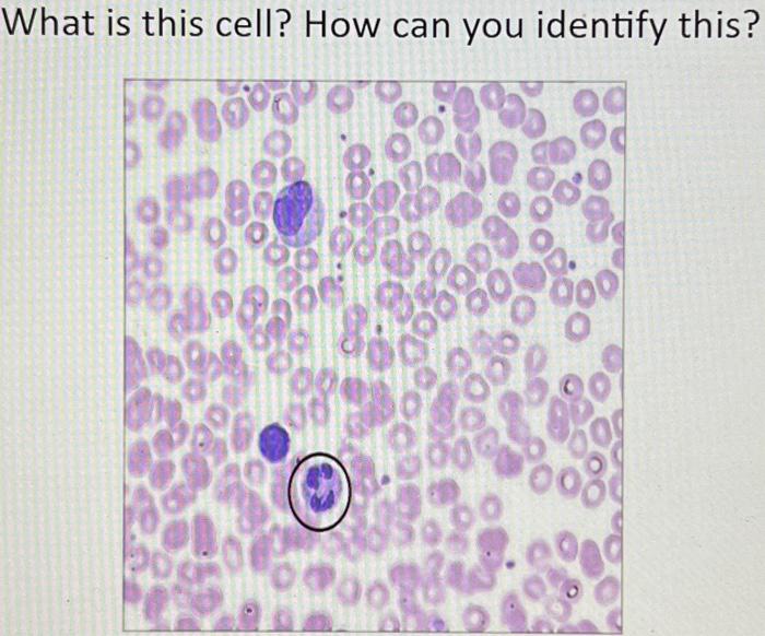 Solved What is this cell? How can you identify this? | Chegg.com