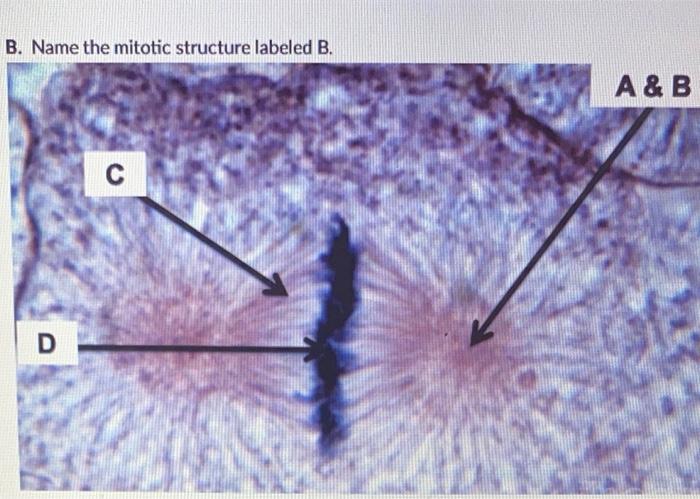Solved B. Name the mitotic structure labeled B. A&B C D | Chegg.com