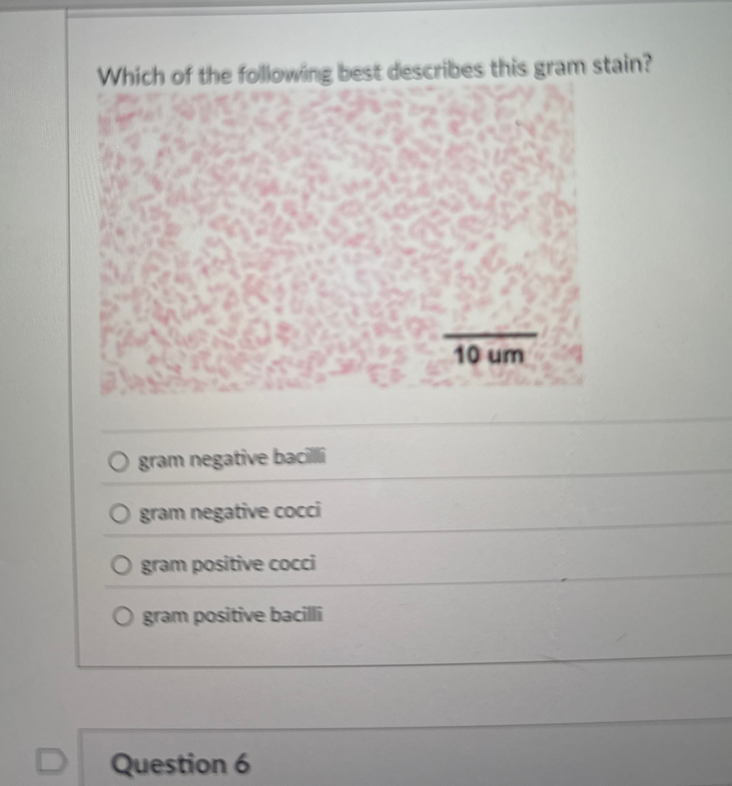 Solved Which of the following best describes this gram | Chegg.com