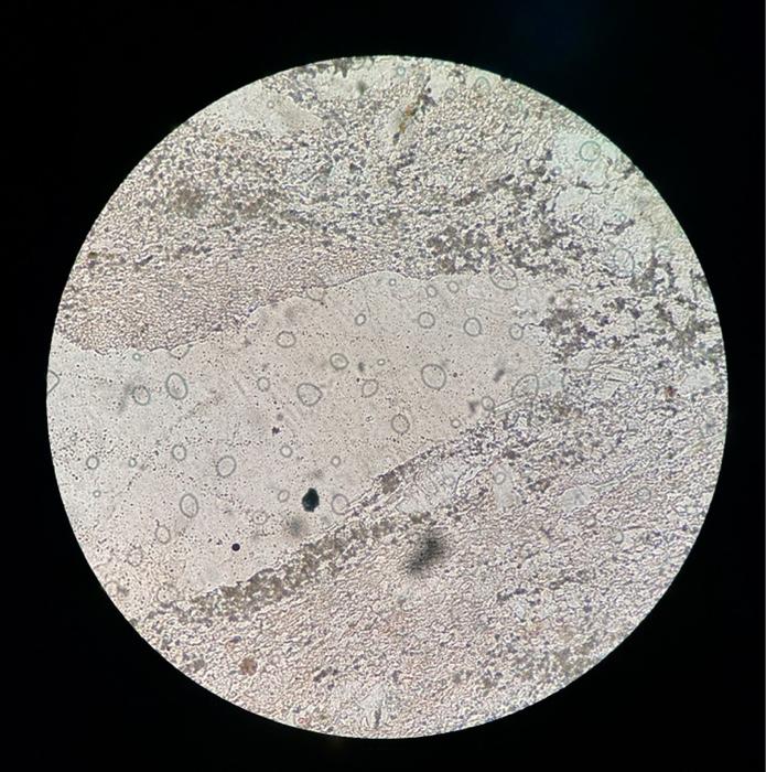 Solved a a. | Chegg.com