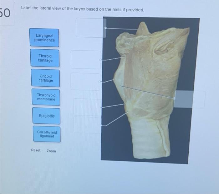 Solved Label the lateral view of the larynx based on the | Chegg.com