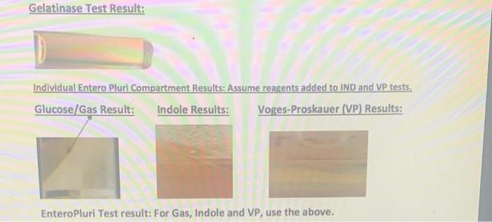 Solved SIM Deep Test: 7. Sulfur Indole Motility (SIM) | Chegg.com