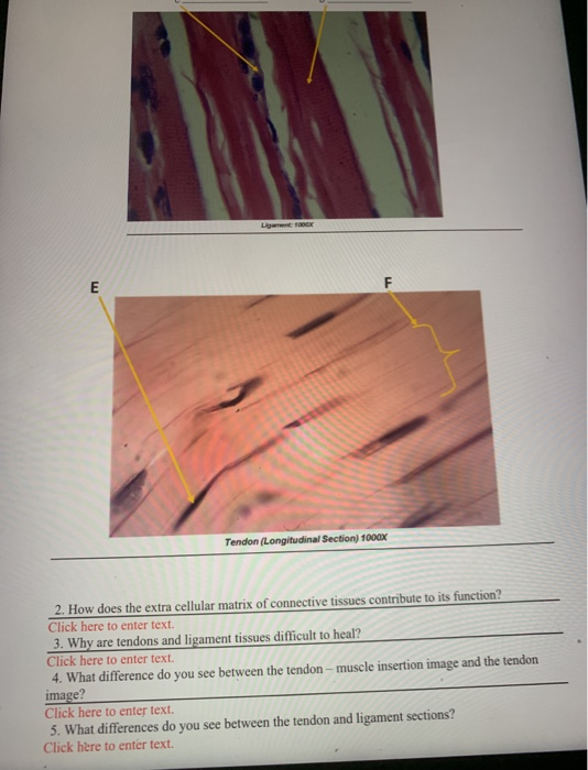 Solved Pre-Lab Questions 1. How do banding patterns change | Chegg.com