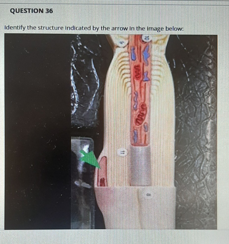 Solved Identify the structure indicated by the arrow in the | Chegg.com