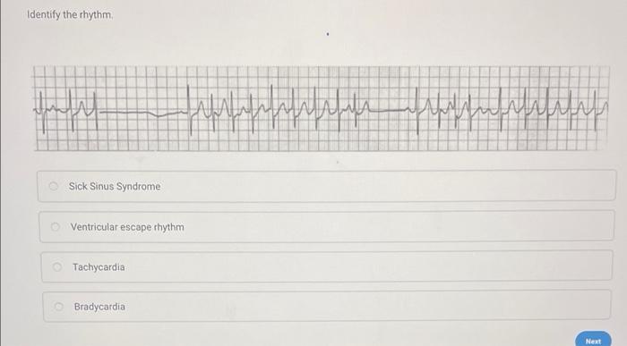 [Solved]: Identify the rhythm, Sick Sinus Syndrome Ventric