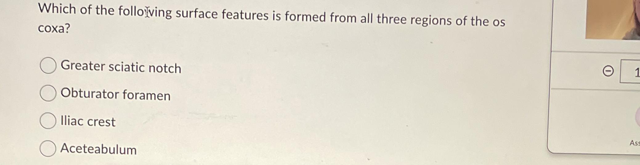 Solved Which of the folloiving surface features is formed | Chegg.com