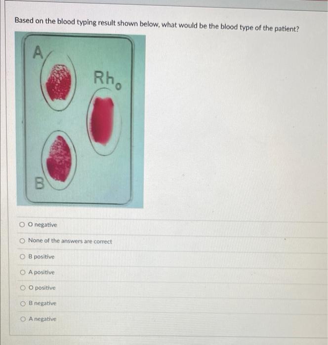 Solved Based on the blood typing result shown below, what | Chegg.com