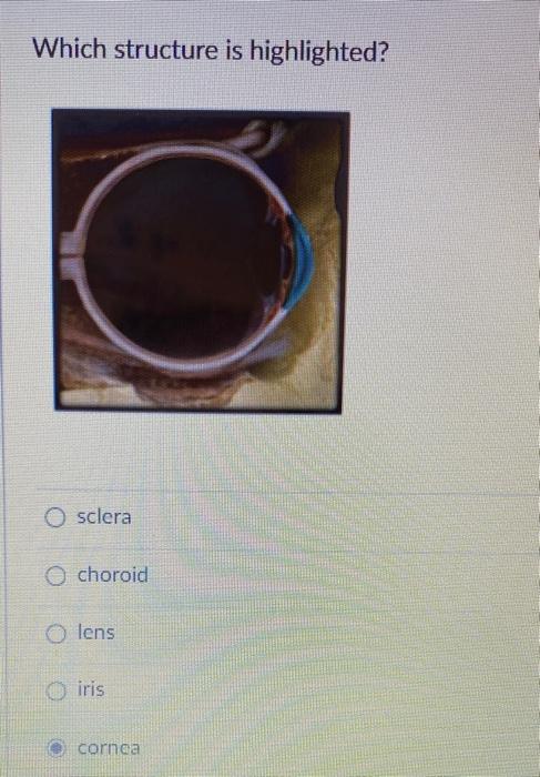 Solved What is highlighted? O vestibular membrane spiral | Chegg.com