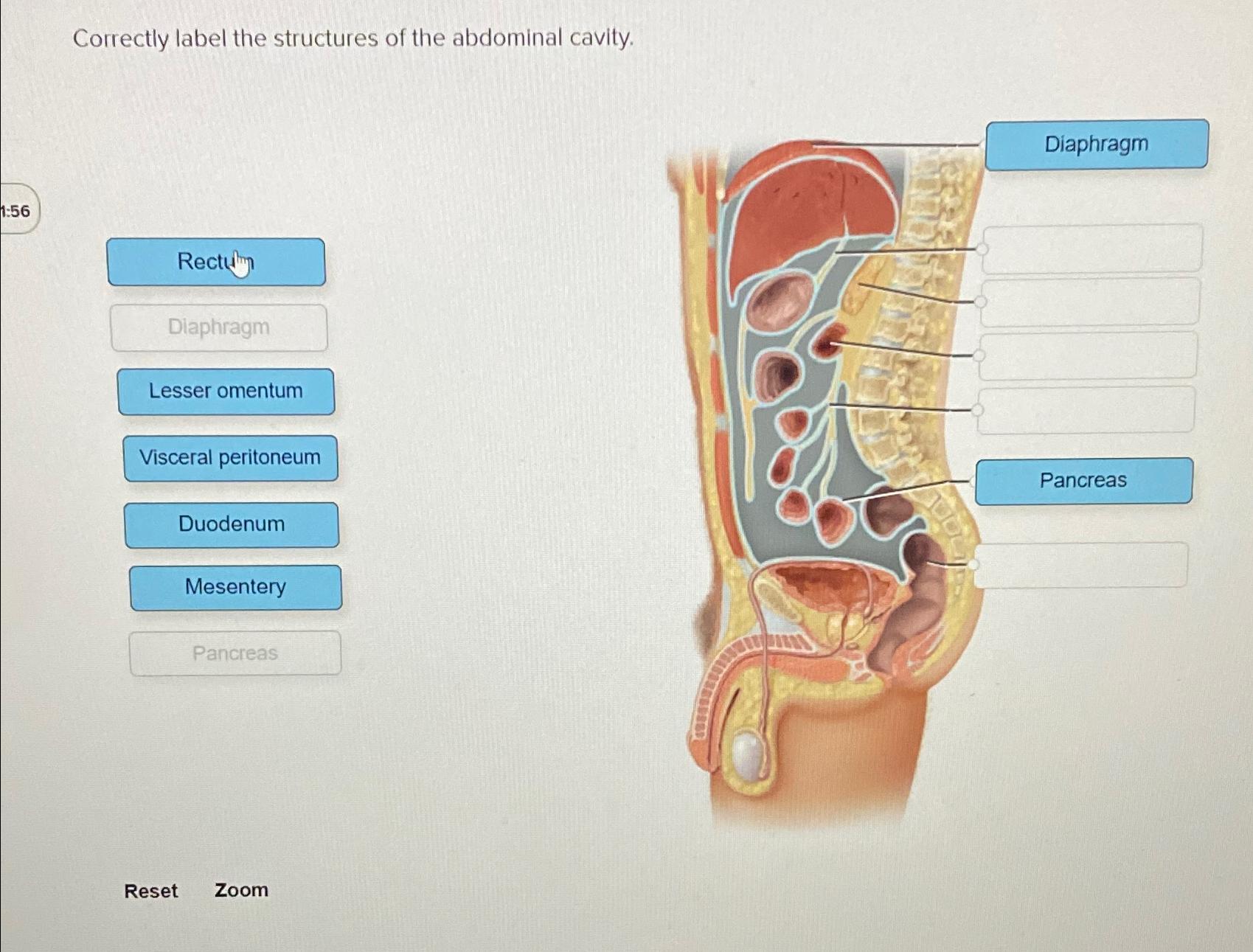 Solved Correctly label the structures of the abdominal | Chegg.com