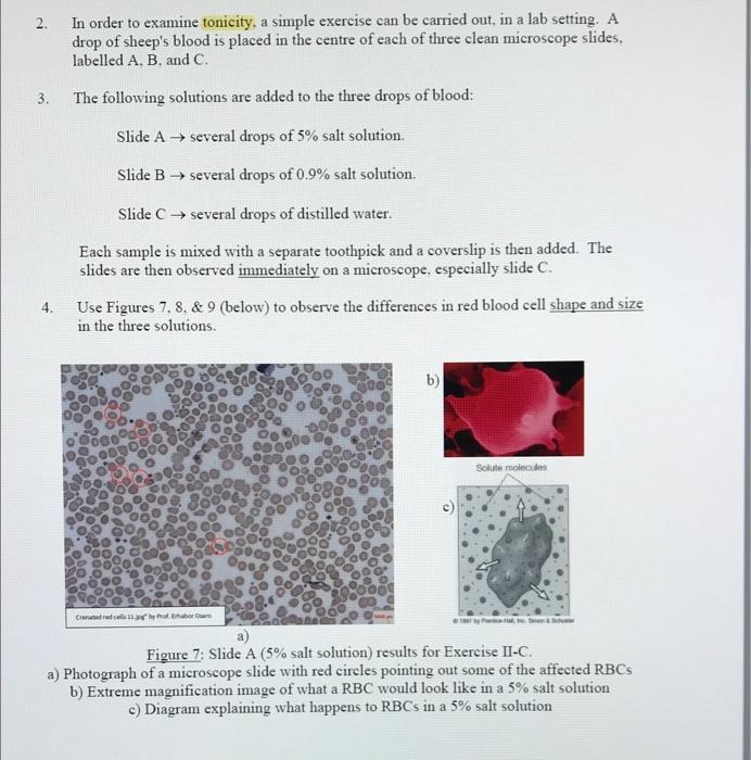 Solved EXERCISE II-C: Red blood cells can be conveniently | Chegg.com
