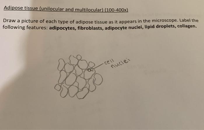 Solved Adipose tissue (unilocular and multilocular) | Chegg.com