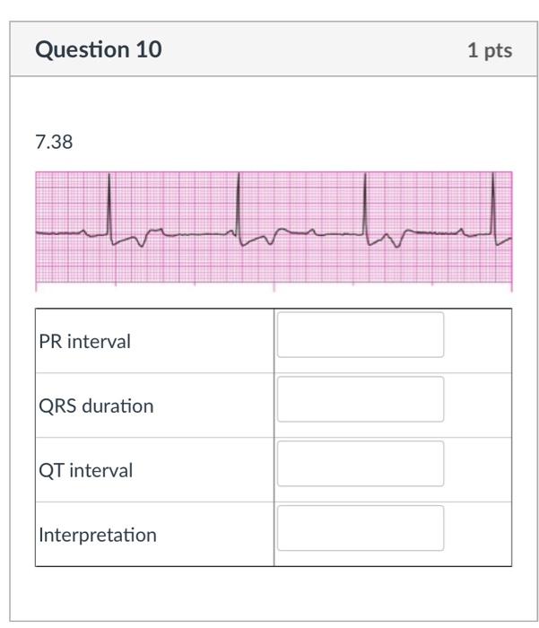 Solved Question 10 1 pts 7.38 PR interval QRS duration QT | Chegg.com