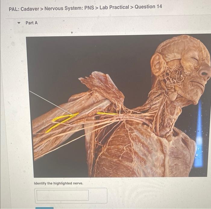 Solved Pal Cadaver Nervous System Pns Lab Practical