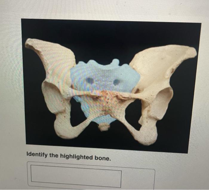 Solved Part A Identify the highlighted structures. | Chegg.com
