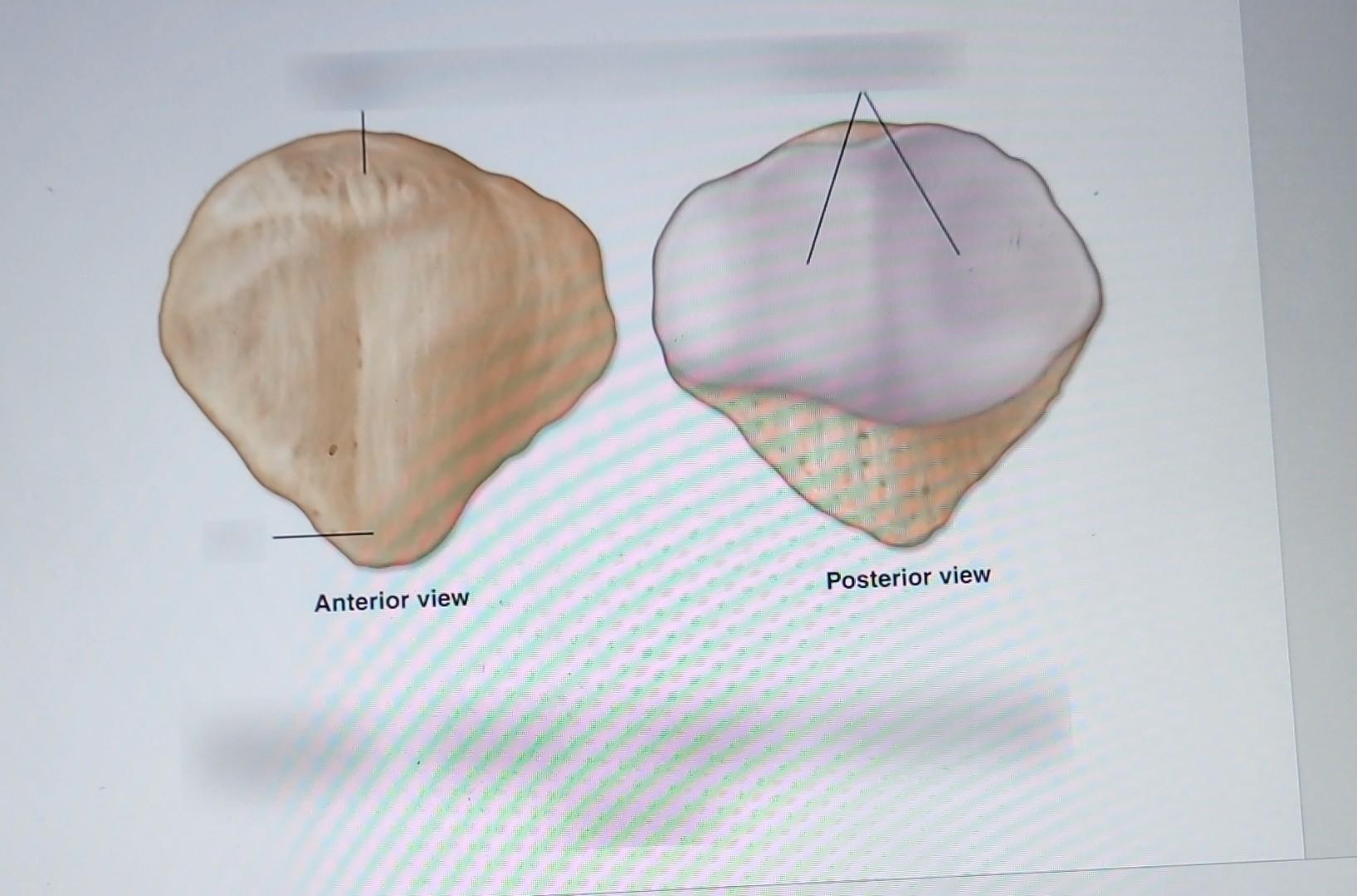 Solved Anterior view Posterior view | Chegg.com