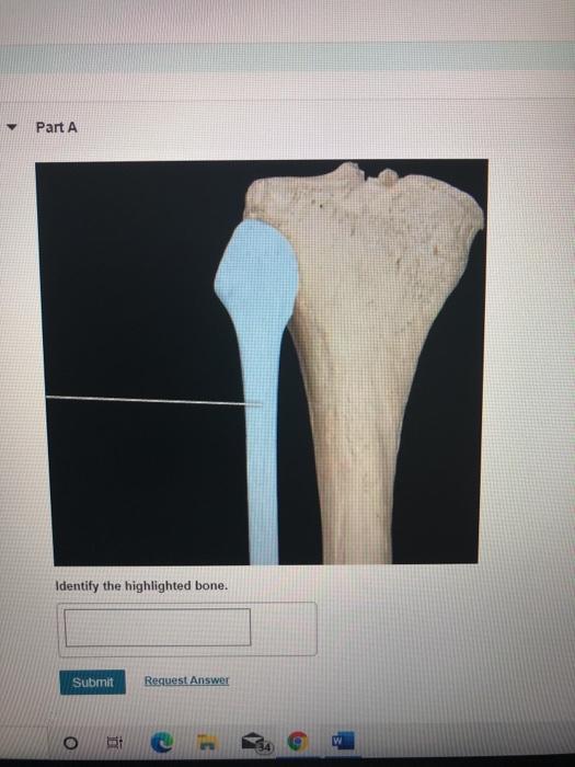 Solved Part A Identify the highlighted bone. Submit Request | Chegg.com