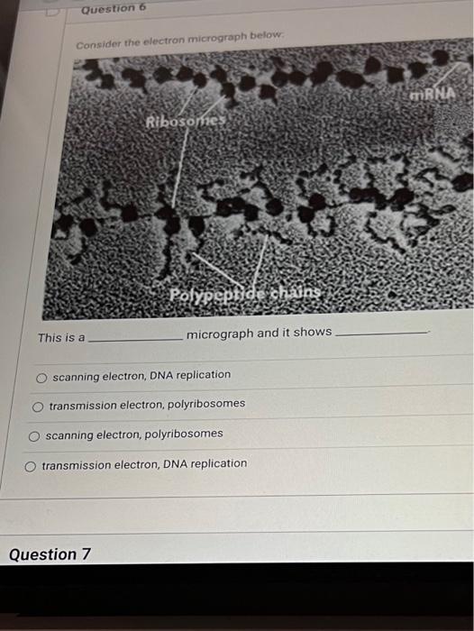 Solved This is a micrograph and it shows scanning electron, | Chegg.com