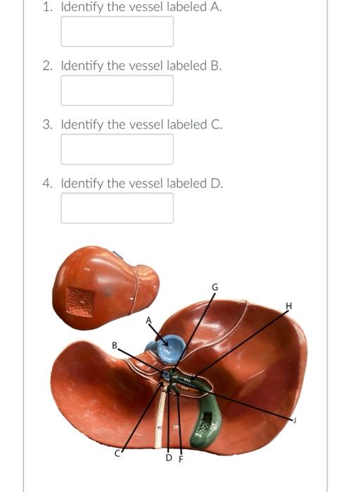 Solved 2. Identify the vessel labeled B. 3. Identify the | Chegg.com
