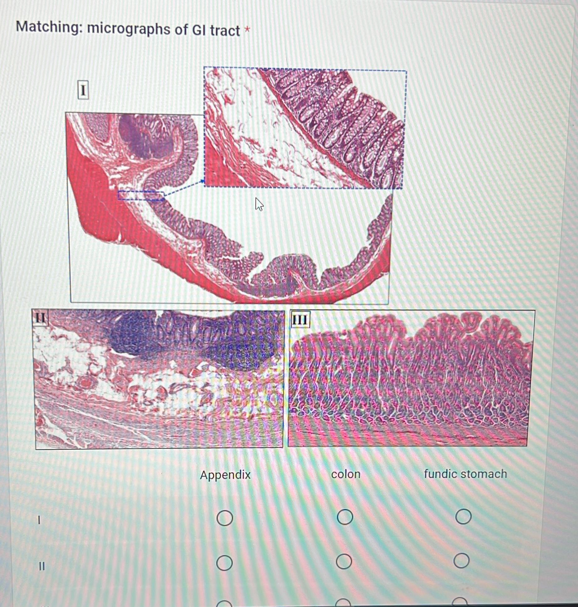 Solved Matching: micrographs of GI tract * | Chegg.com
