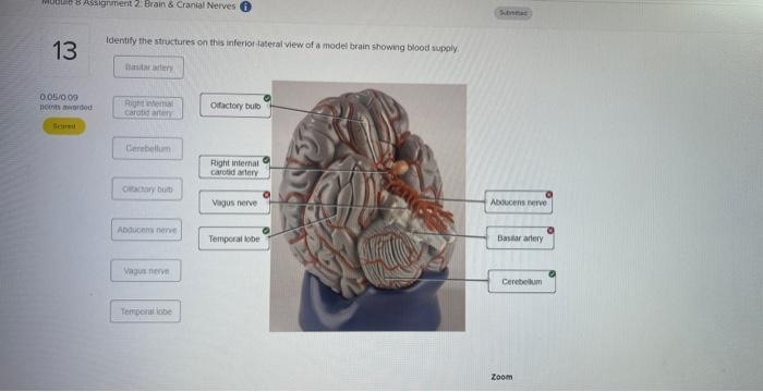 Solved Identify the structures on this inferior-tateral view | Chegg.com