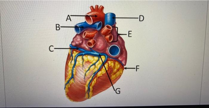 Solved identify blood vessels and structures | Chegg.com