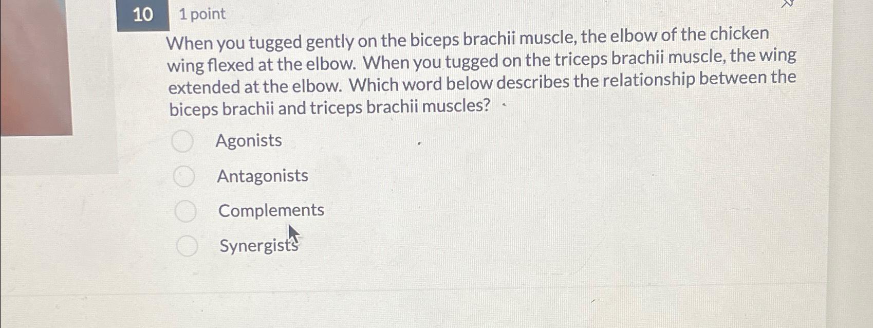 Solved 101 ﻿pointWhen you tugged gently on the biceps | Chegg.com