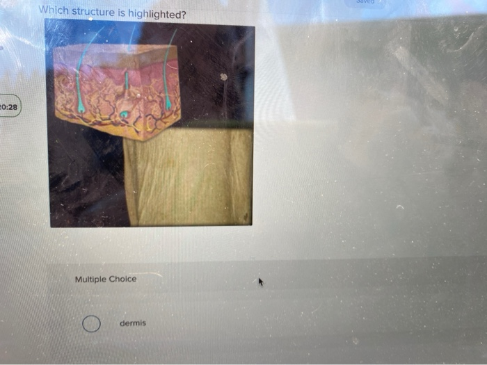 Solved Javo Which structure is highlighted? 20:28 Multiple | Chegg.com