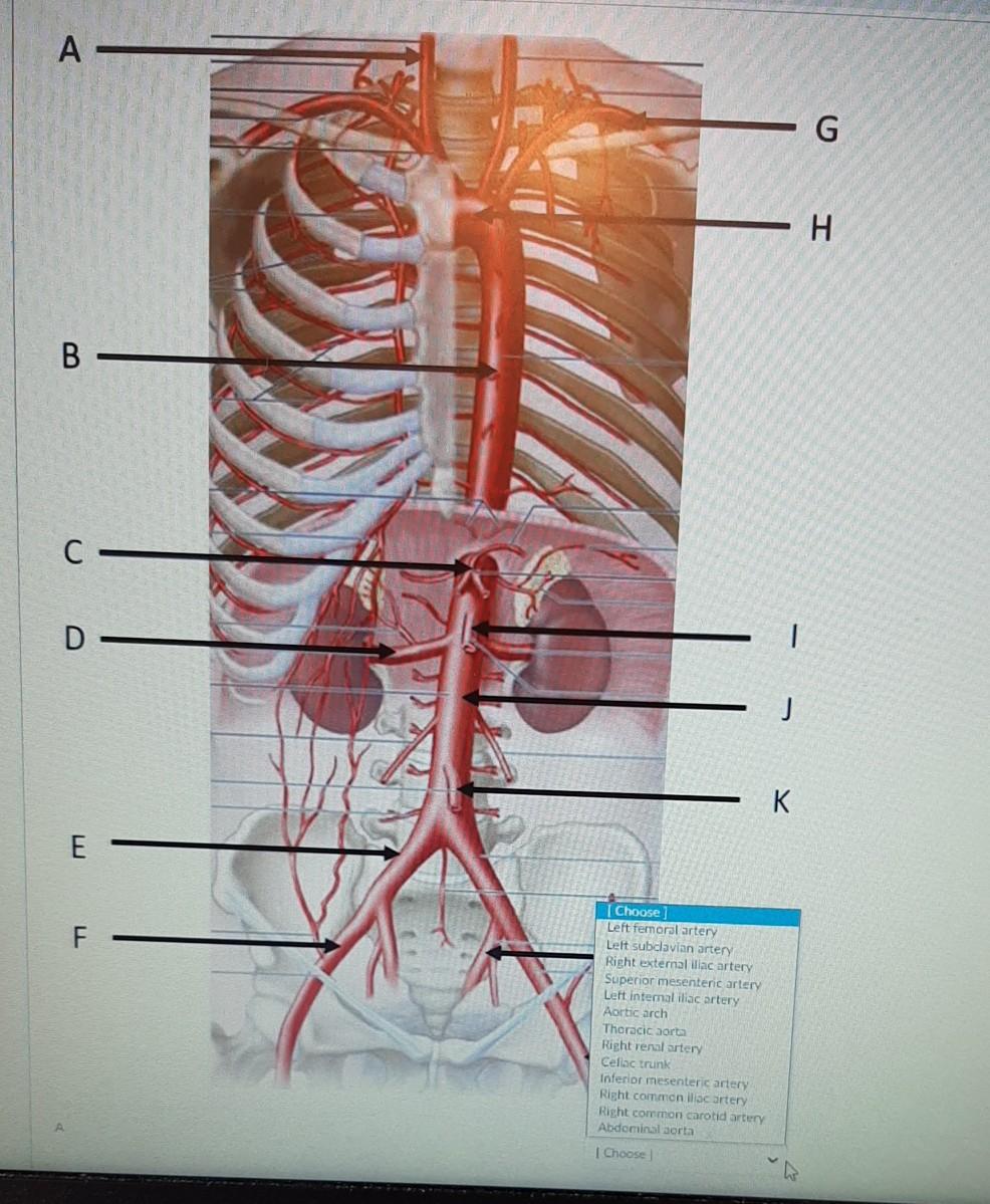 Solved A G H B С D J K E חד Choose] Left femoral artery Lelt | Chegg.com