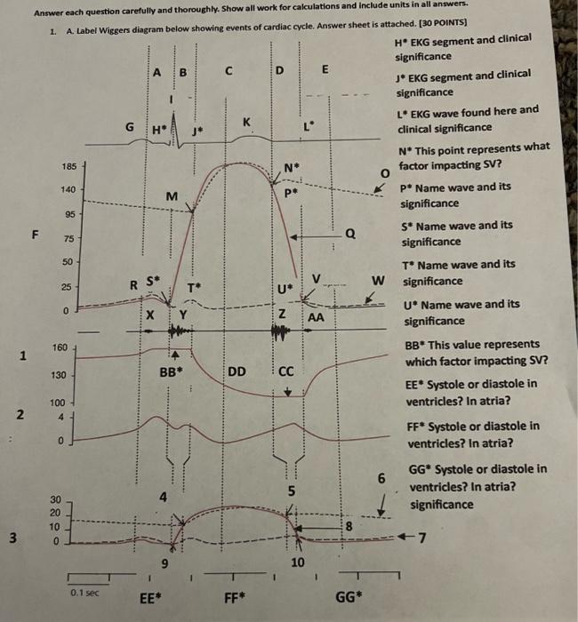 Solved hed. [30 POINTS] - EKG segment and clinical | Chegg.com