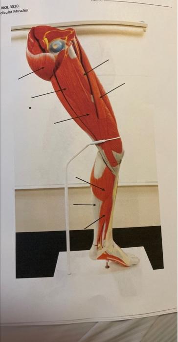 Solved Labeling Appendicular Muscles | Chegg.com