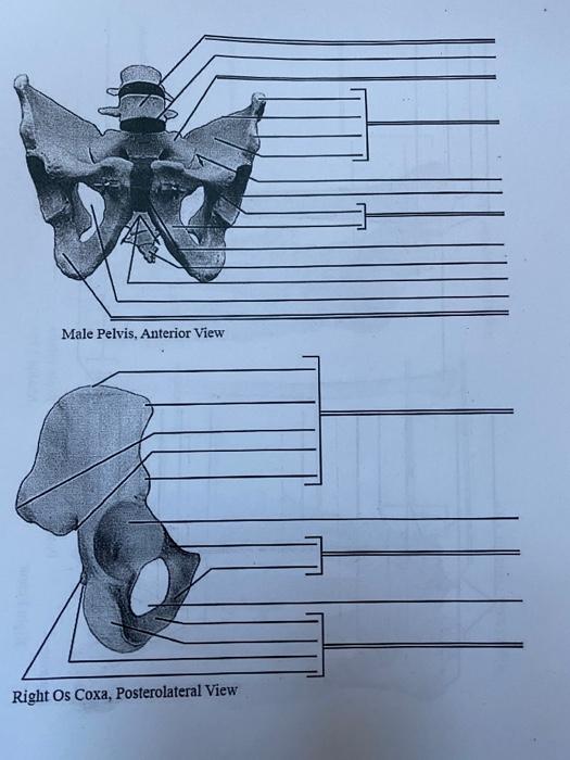 Solved Atlas, Superior View Axis. Posterior Superior View | Chegg.com