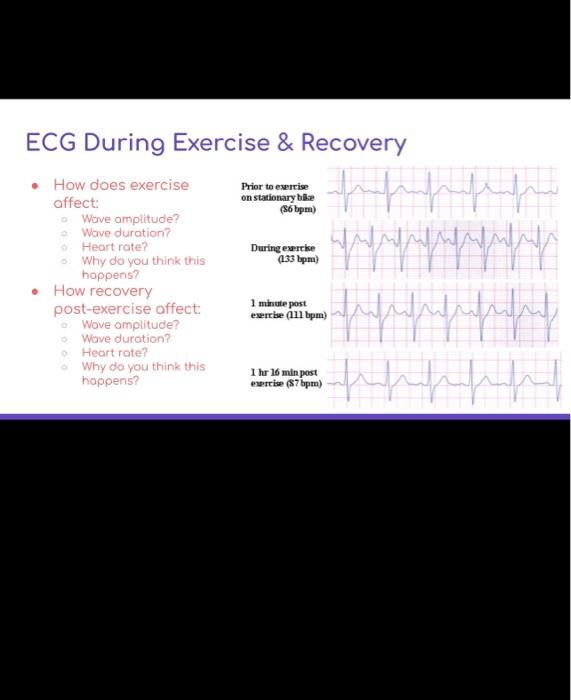 Solved ECG During Exercise \& Recovery | Chegg.com