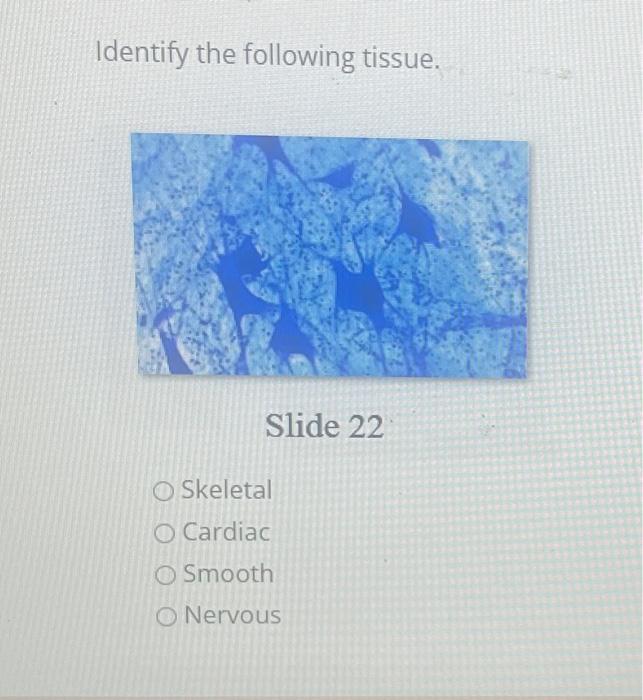 Solved Identify the following tissue. Slide 22 Skeletal | Chegg.com