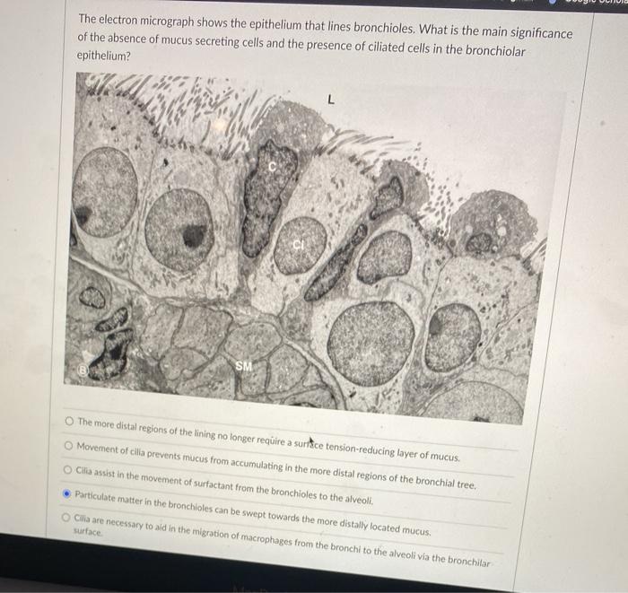 Solved The electron micrograph shows the epithelium that | Chegg.com
